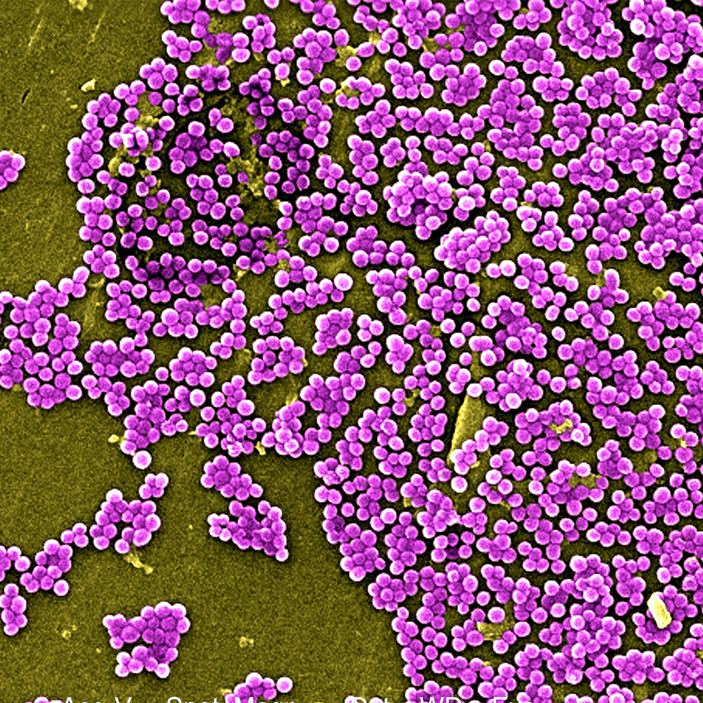 MRSA, Staph & Infection Prevention for the Maritime Industries – Moxie ...