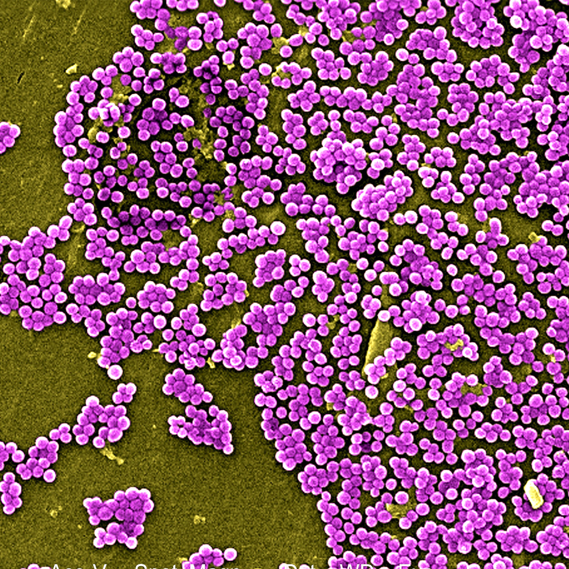 MRSA, Staph & Infection Prevention for the Maritime Industries – Moxie ...